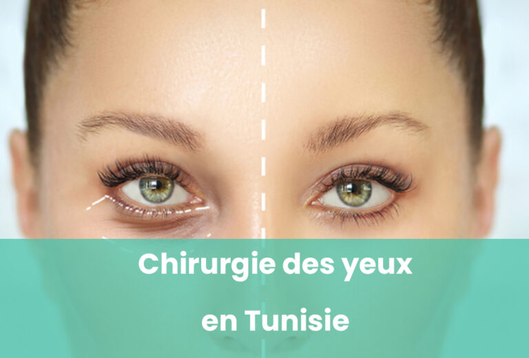 Chirurgie des yeux - Opération laser des yeux prix Tunisie