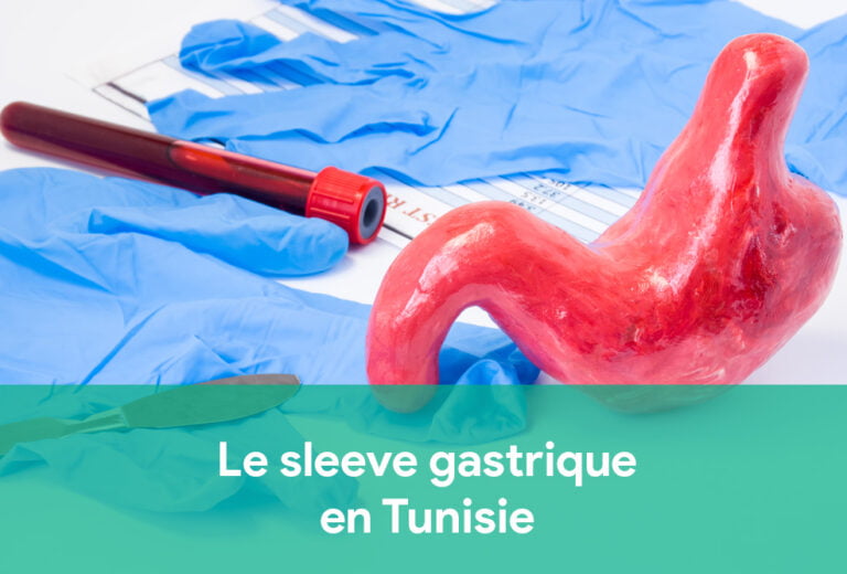 Sleeve gastrique en Tunisie à bas prix - Chirurgie de l'obésité